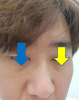 유노윤호의 미용외과 성형외과 이야기 네이버 블로그